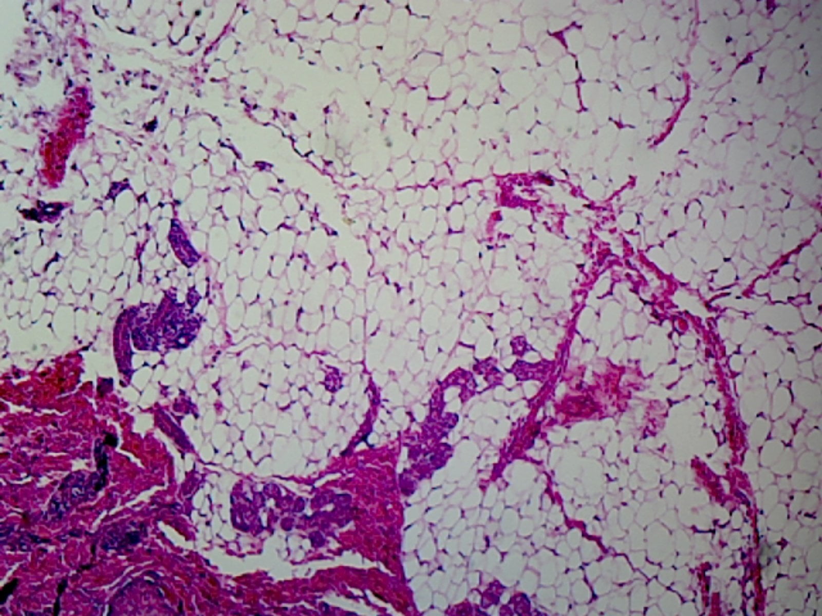 GSC International PS0177 Mammalian Adipose Tissue Section H&E Stain ... GSC International PS0177 Mammalian Adipose Tissue Section H&E Stain ...