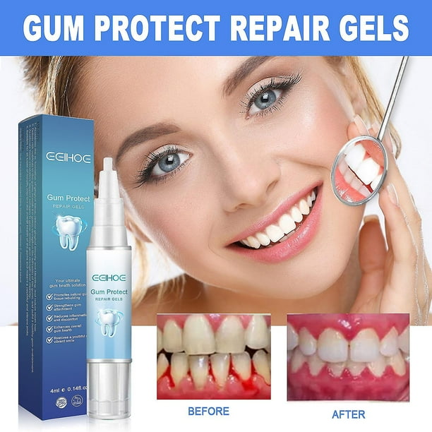 Gum Repair Gel Rebuilding Strengthen Whiten Remove Breath Inflammation ...