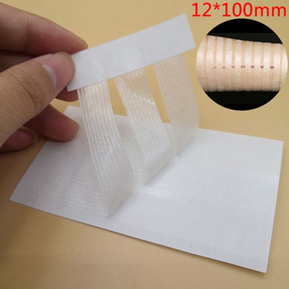 steri-strips