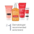 Neutrogena All-In-1 Acne Control Daily Facial Acne Scrub, 4.2 fl. oz ...