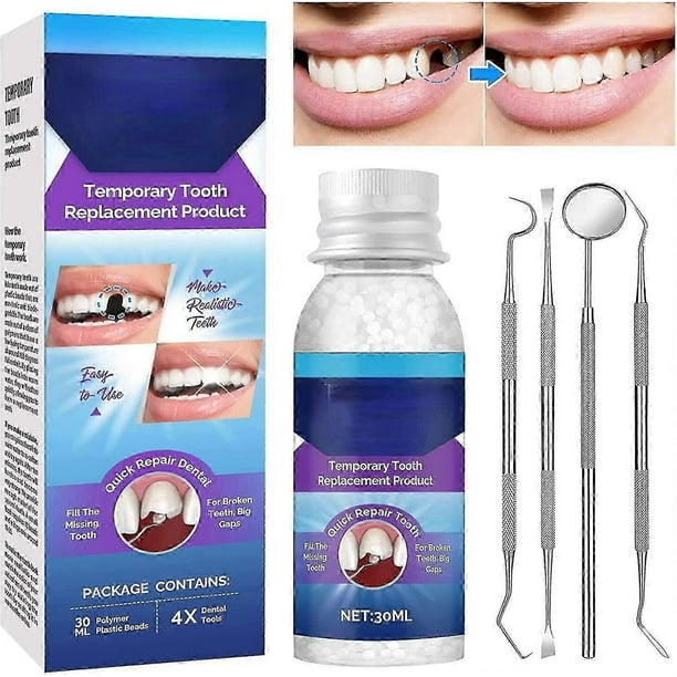 Tooth Repair Kit, Temporary Teeth Replacement Kit, Fixing Missing And ...