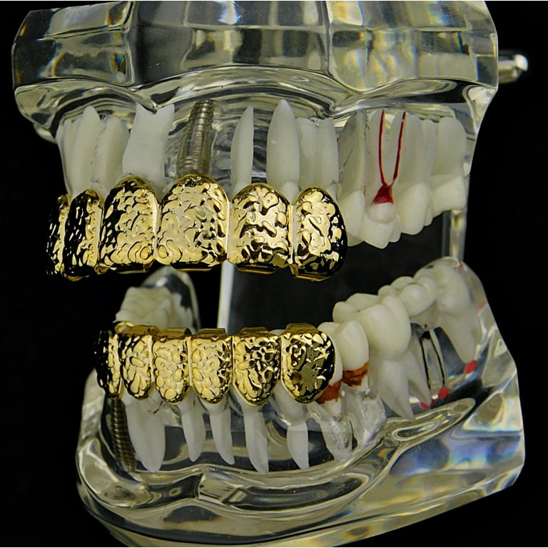 Gold Teeth Designs