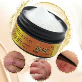 Cortisone Cream | Walmart Canada