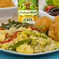 Treasure Trading Linstead Market Jamaican Ackee, 19 oz - Exotic ...