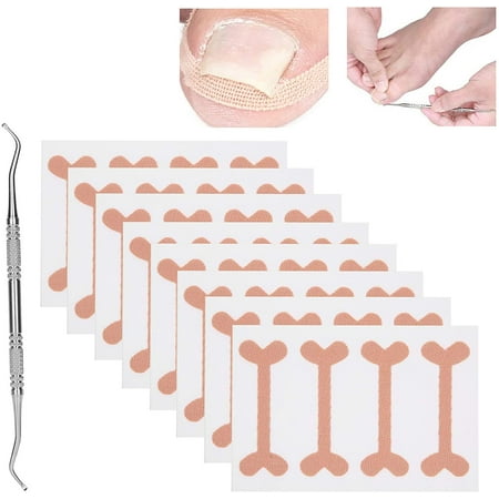 Ingrown Toenail Correction Sticker, 9pcs Ingrown Toenail Correction ...