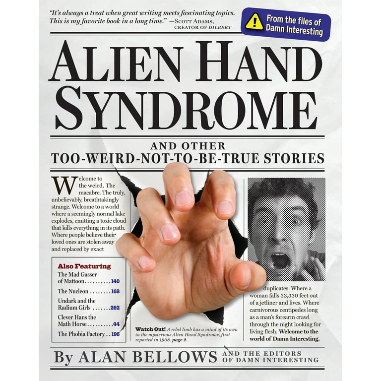 Alien Hand Syndrome