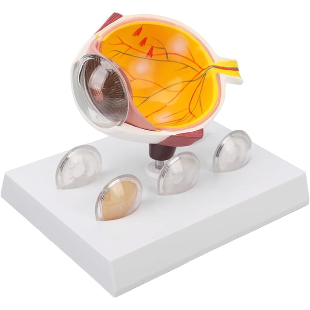 Human Eye Anatomy Model - Shows Optic Details, Eyeball Anatomical ...
