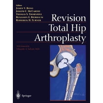 Total Hip Replacement: Techniques and Complications, (Hardcover ...