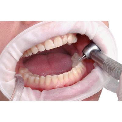 Ivoclar Vivadent 577275 OptraGate 3D Lip & Cheek Retractor Assortment ...