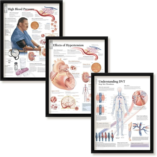 Set of 3 Framed Medical Posters High Blood Pressure, Effects of ...