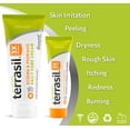 Terrasil® Eczema & Psoriasis 2-Tube Outbreak Ointment and Daily Use ...
