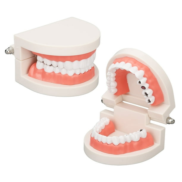 Disease Teeth Model, Portable Clear Structure Resin Education Caries ...