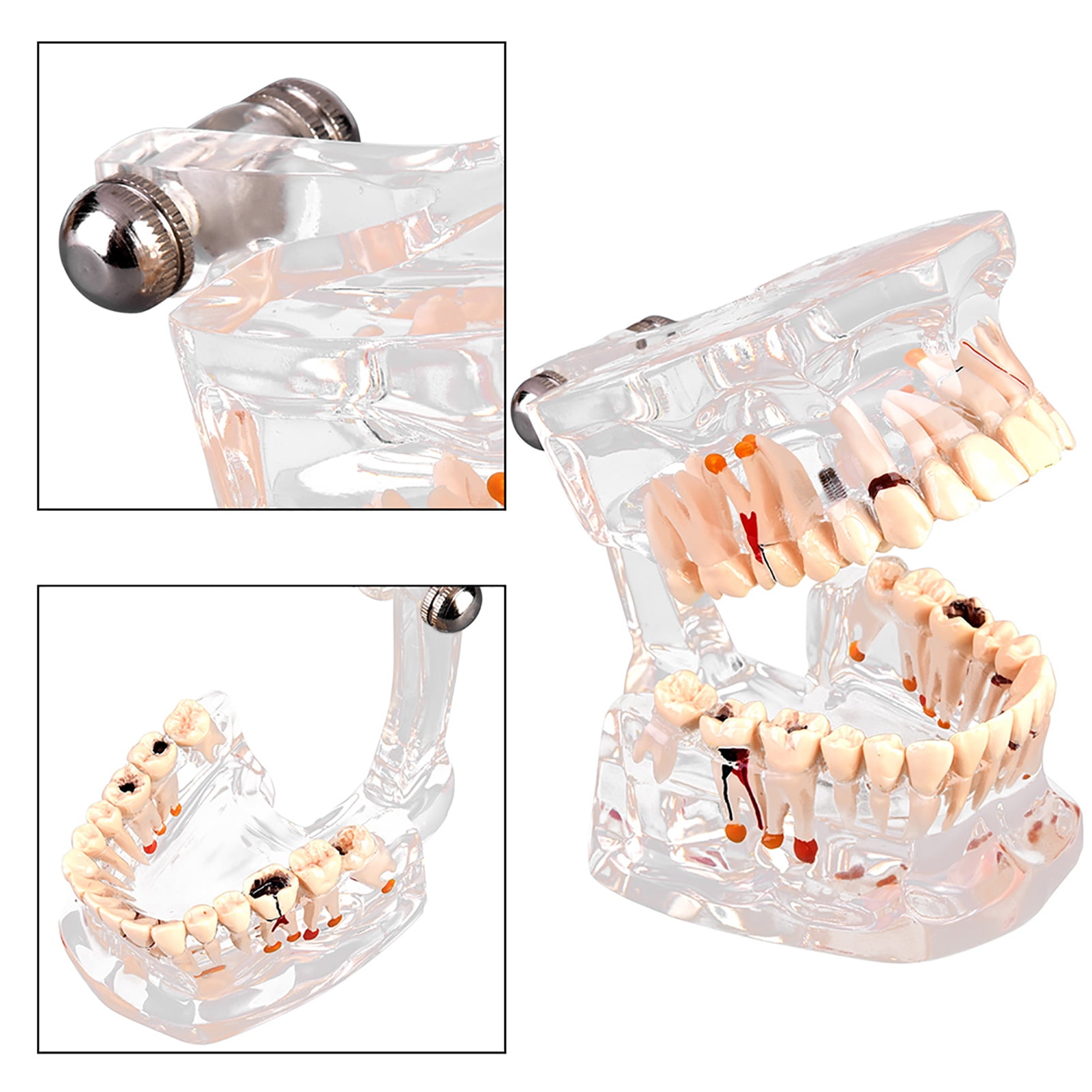 Tooth Model, Small Size Tooth Education Model Clear Structure High ...