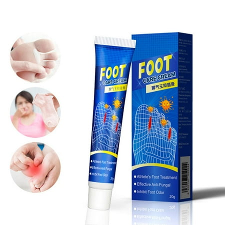 Athlete's Foot Cream Antifungal Cream Moisturizing External Athlete's ...