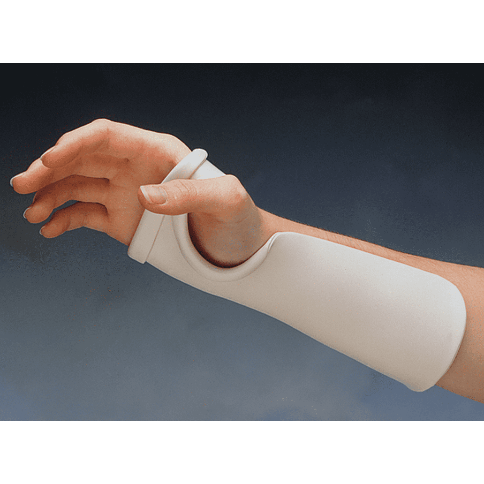What Is A Volar Finger Splint at Justin Wells blog