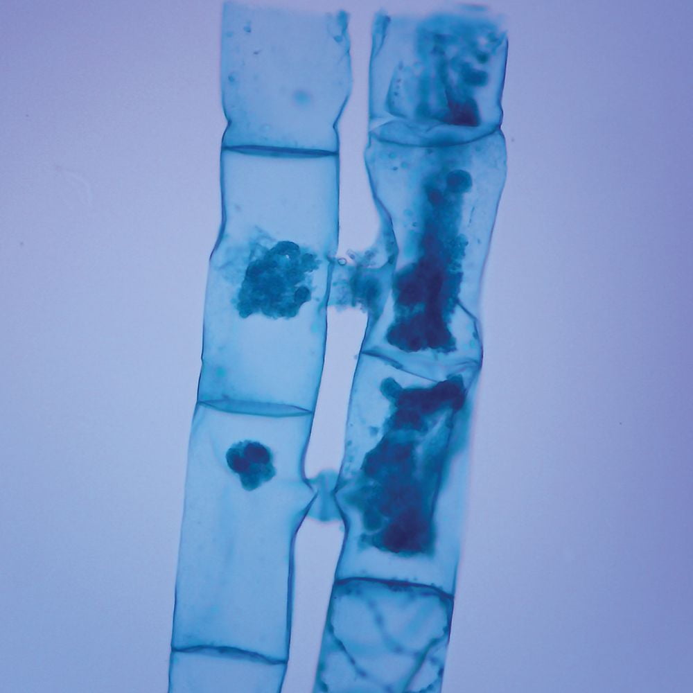 Spirogyra Vegetative Slide