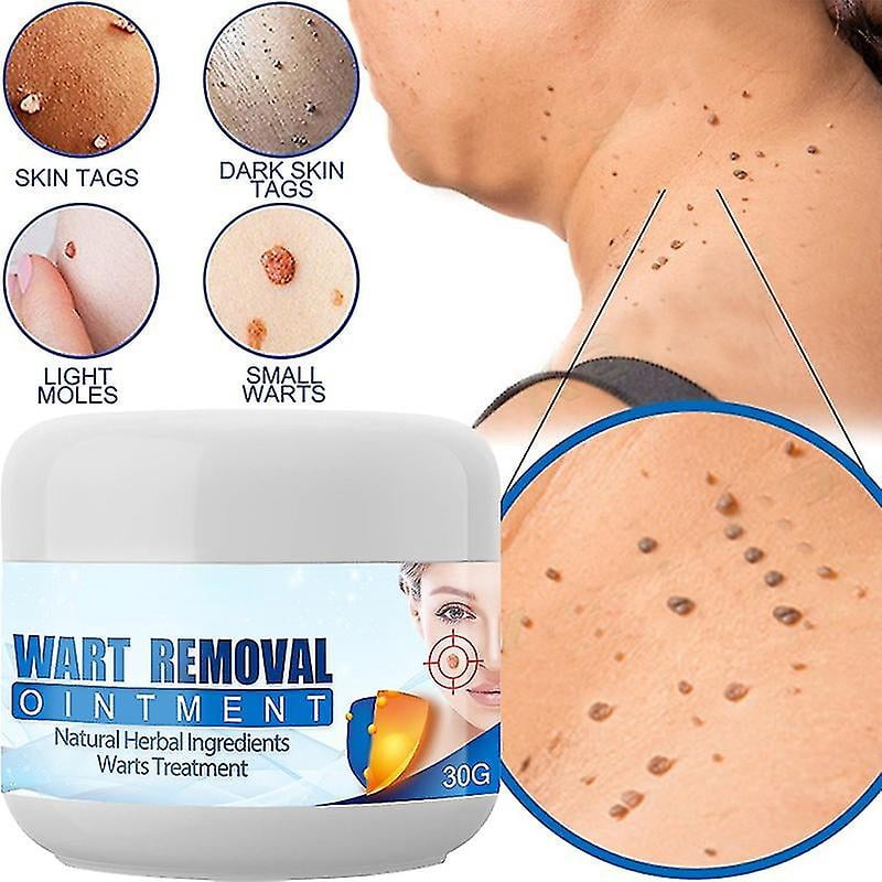 Crema Eliminadora De Verrugas Indolora Tratamiento De La Piel Del ...
