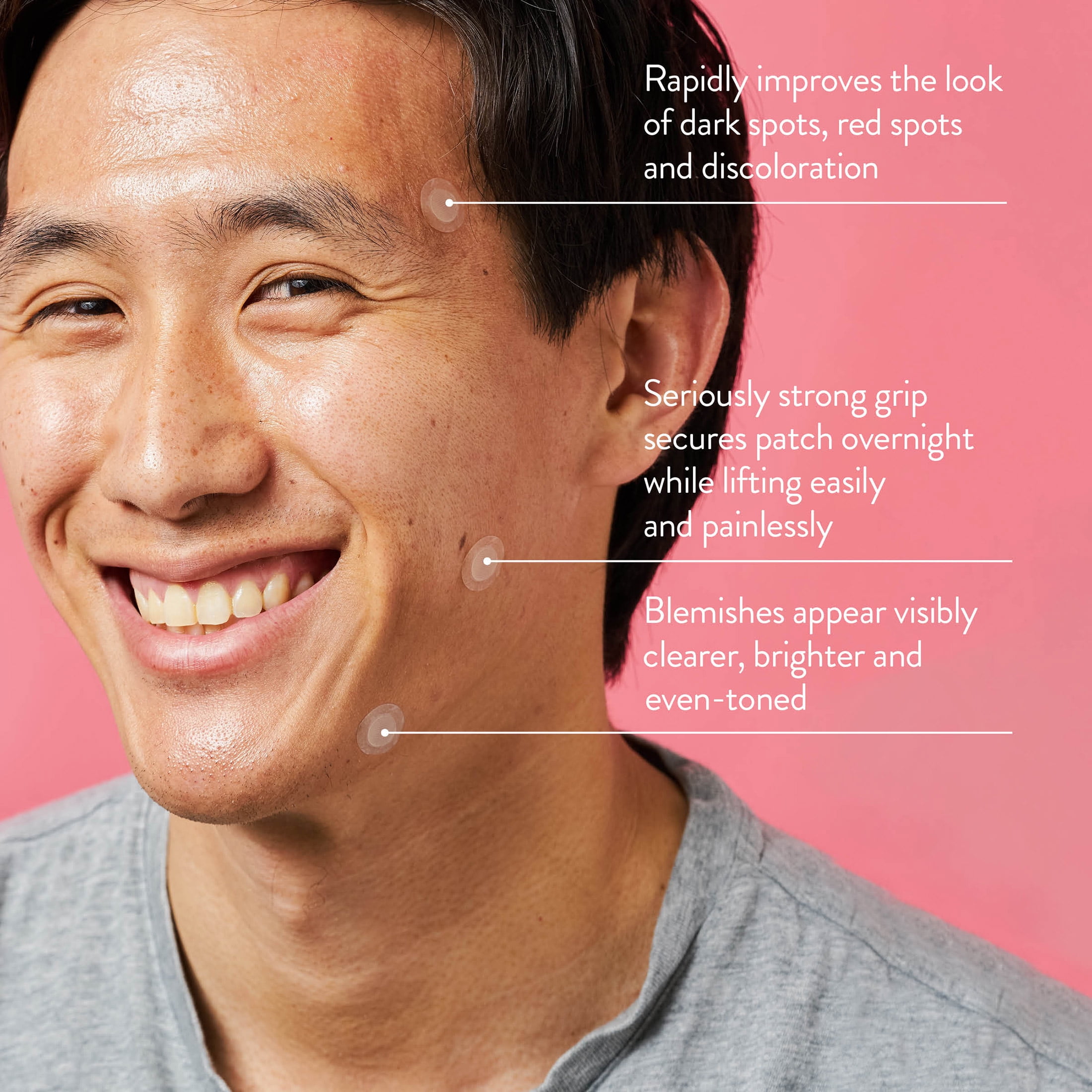 Peach Slices Dark Spot Microdarts, Transparent Hyperpigmentation Patch ...