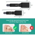 Welnove Hammer Toe Straightener - 8 Pack Broken Toe Wraps & Toe Splints ...