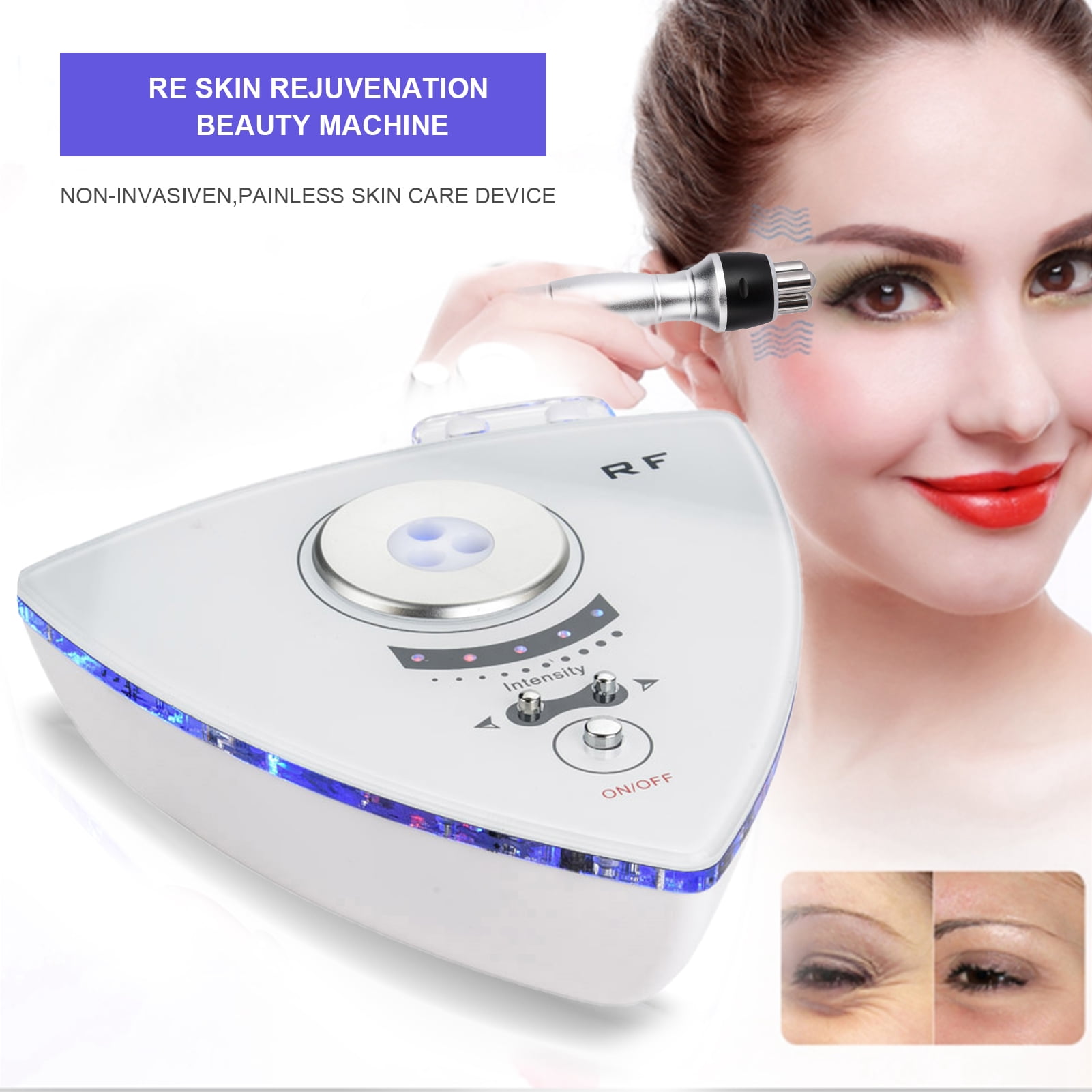 EBTOOLS Handheld Electric RF RadioWrinkle Removal Skin Lifting ...