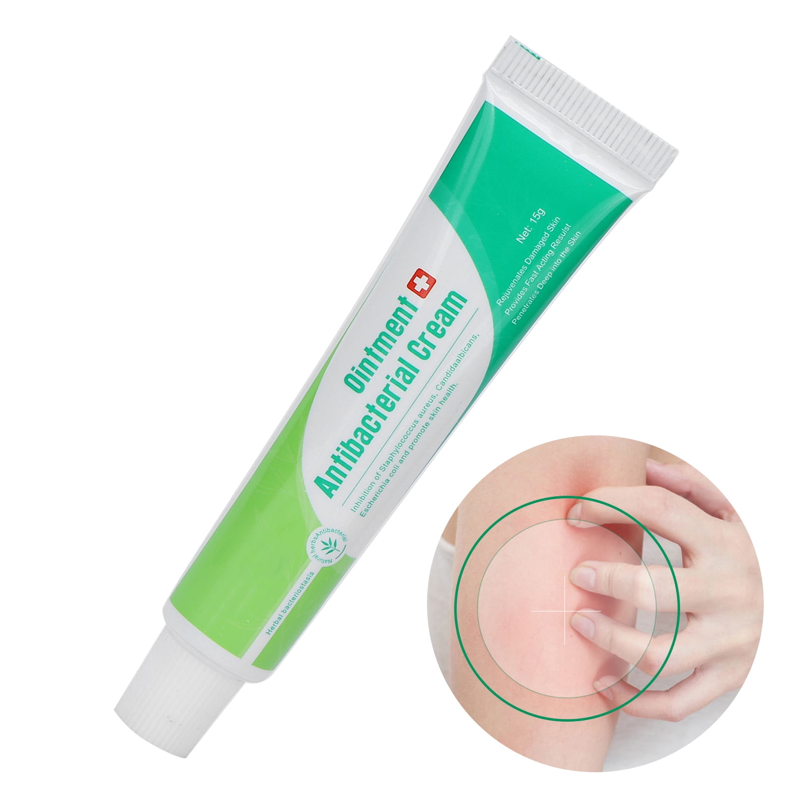 Crema antipicazón de 15 g ungüento reparador de la piel para aliviar la ...