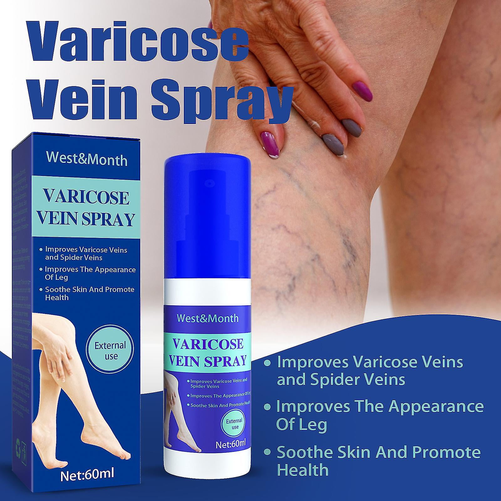 1Pcs Spray para venas varicosas, spray refrescante, para flebitis ...