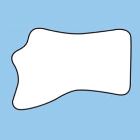 Radial Gutter Splint Pattern