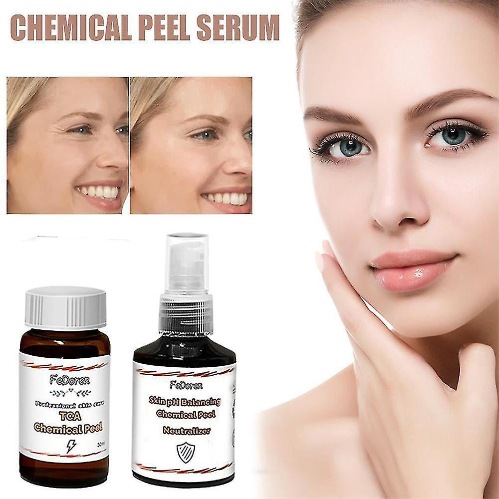 1-3 uds Tca 30% Tca Peel Acid Peeling Acid 7-15 días de entrega piel ...