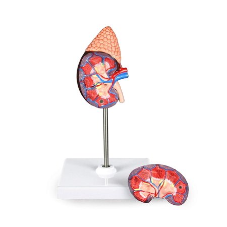 S09030 Life-Size Kidney Model - 2 Parts | Median Sagittal Sectioned ...