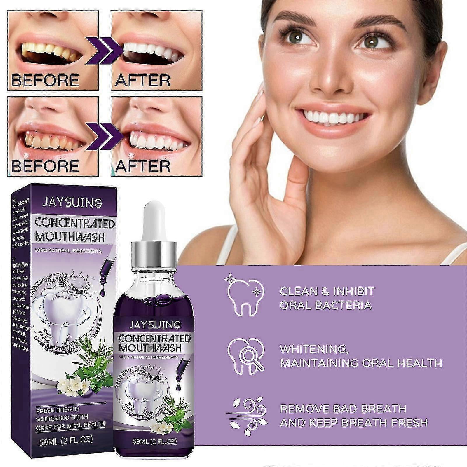 Jaysuing Portable Mouthwash Fresh Breath Remove Stain Bad Breath Odor ...