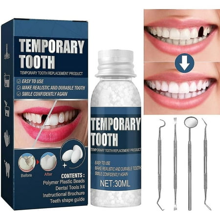 Tooth Repair Kit, Temporary Teeth Filling Repair Kit, Fixing The ...
