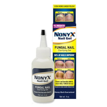 Nonyx Fungal Nail Clarifying Gel, Toenail Fungus Treatment that Cleans ...