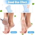 3 Pairs Aloe Socks Moisturizing Spa Infused Gel Sleeping Fuzzy Dry Feet ...