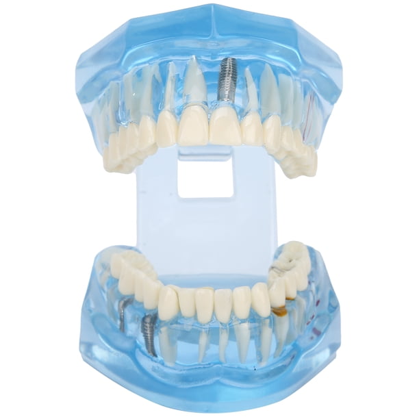 Dental Patient Education Models