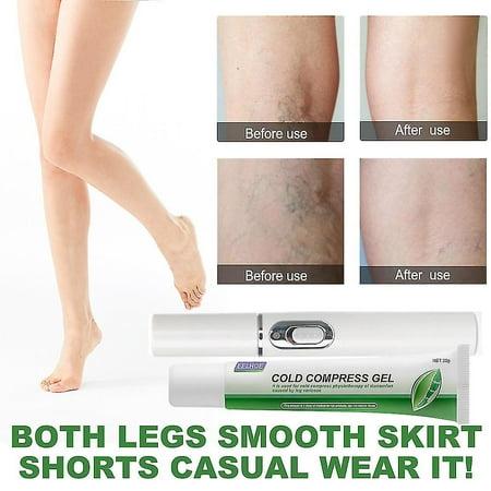 20g Leg Cold Compress Gel For Relief Varicose Veins Phlebitis ...
