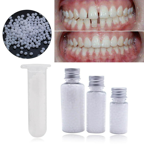 pitrice 10G Temporary Tooth Solid Glue Thermal Beads Teeth Gaps Glue ...