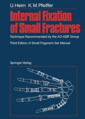 Pre-Owned Internal Fixation of Small Fractures: Technique Recommended ...
