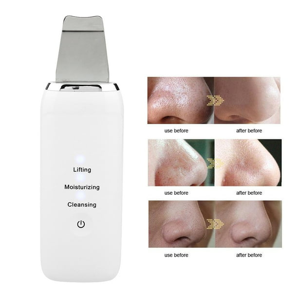 Blackhead Removal Machine,Ultrasonic Face Skin Scrubber Exfoliating ...