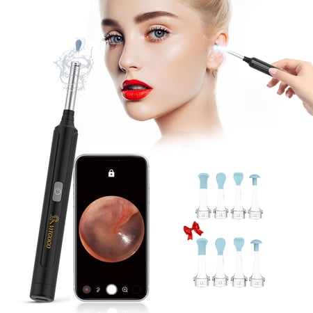 VITCOCO Ear Wax Remover, Ear Cleaner Ear Wax Removal Kit, Wireless ...
