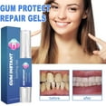 Wiquokett Gingival Care Gel Swelling And Of Receding Gums Cleans Stains And Teeth 4ml