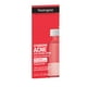 Neutrogena Stubborn Acne Spot Drying Acne Treatment, 10% Sulfur, 1 oz ...