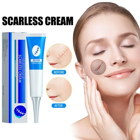 Archer 20g Scar Cream Easily Penetrate Quick Effect Natural Gentle ...