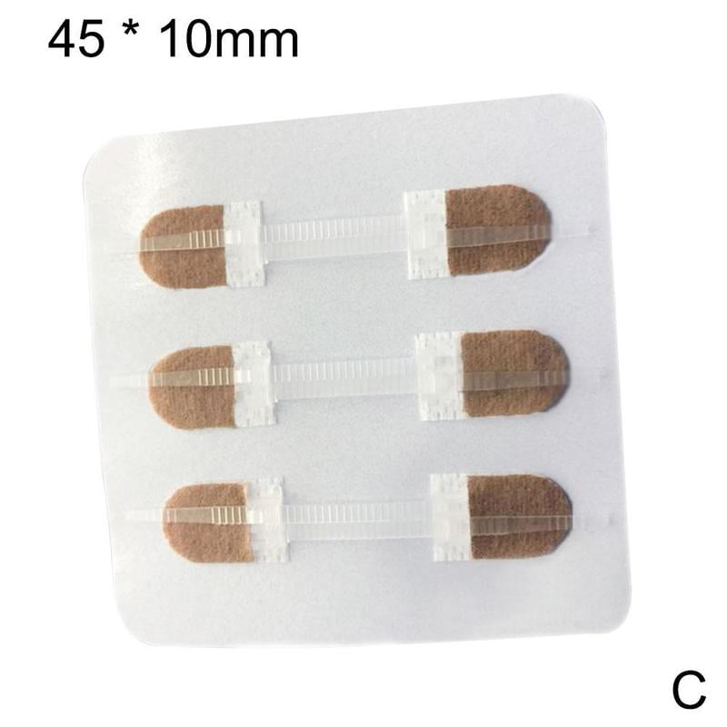 Buy Suture-free Wound Patch Stitchless Portable Laceration Patch ...