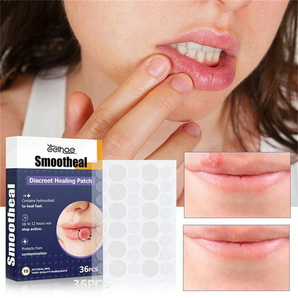 Cold Sore Smootheal Patches Cold Sore Discreet Healing Patch - A Patch ...