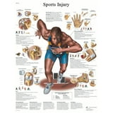 Anatomical chart: sports injuries, paper - Walmart.com