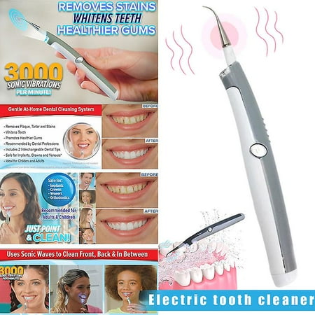 Electric Ultrasonic Tooth Stain Plaque Remover Tool Teeth Whitening ...