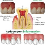 Gum Relief Drops, Gum Therapy Gel For Damaged Gum, Repair Gum Regrowth ...
