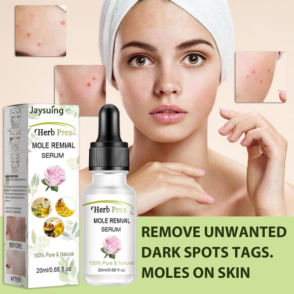 Best Mole Remover