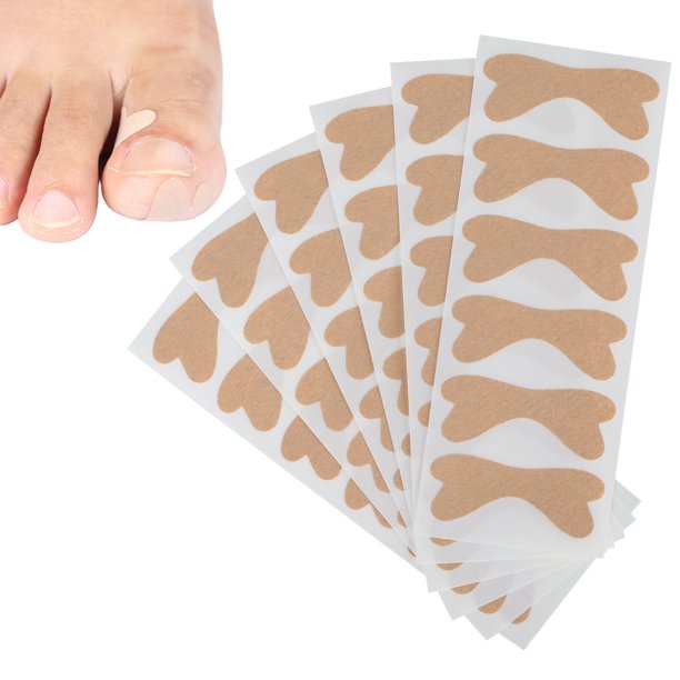 Foot Care Stickers,Professional Non-Glue Ingrown Toenail Correction ...