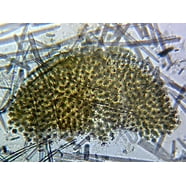 Fern (Pteridophyta) Prothallium, Showing Gametophytes; Cross Section by ...